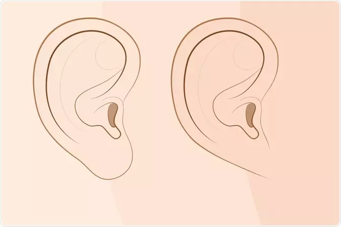 Genetics sa Earlobes