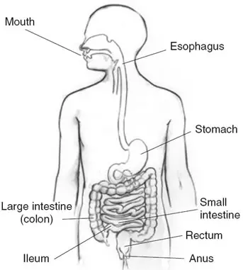 Co je Crohnova choroba?