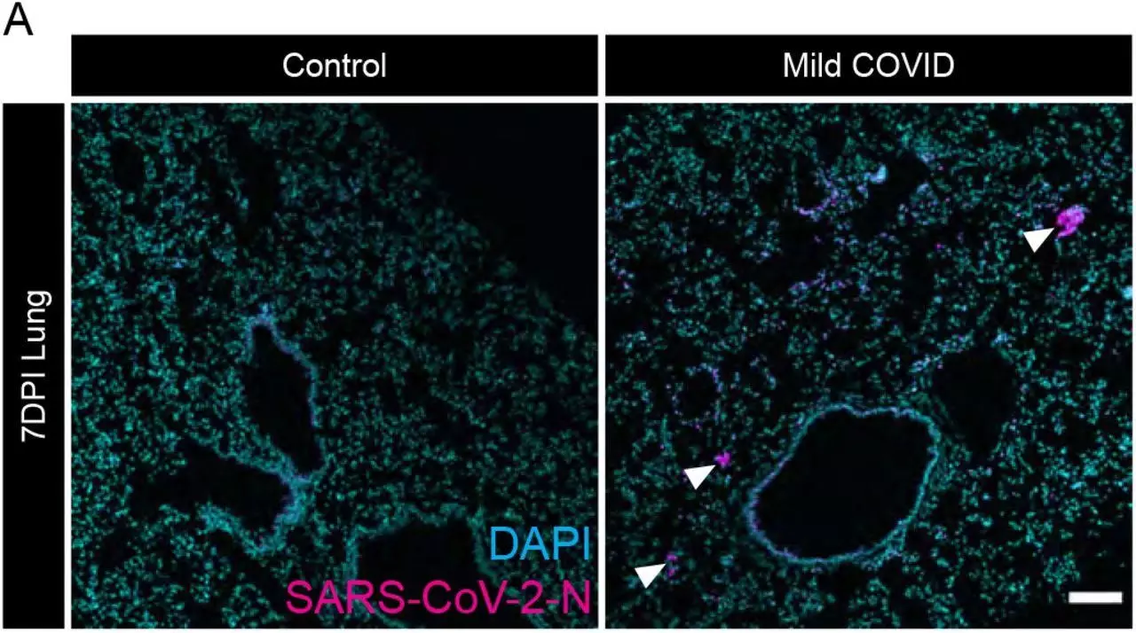 Bukti infeksi SARS-CoV-2 di paru-paru model tikus COVID pernapasan ringan (A) Mikrograf confocal representatif dari protein nukleokapsid SARS-CoV-2 (SARS-CoV-2-N, magenta; DAPI, cyan) di paru-paru tikus 7- hari pasca infeksi. Tanda panah menyoroti imunostaining protein nukleokapsid SARS-CoV-2-N. Bilah skala 100μm.