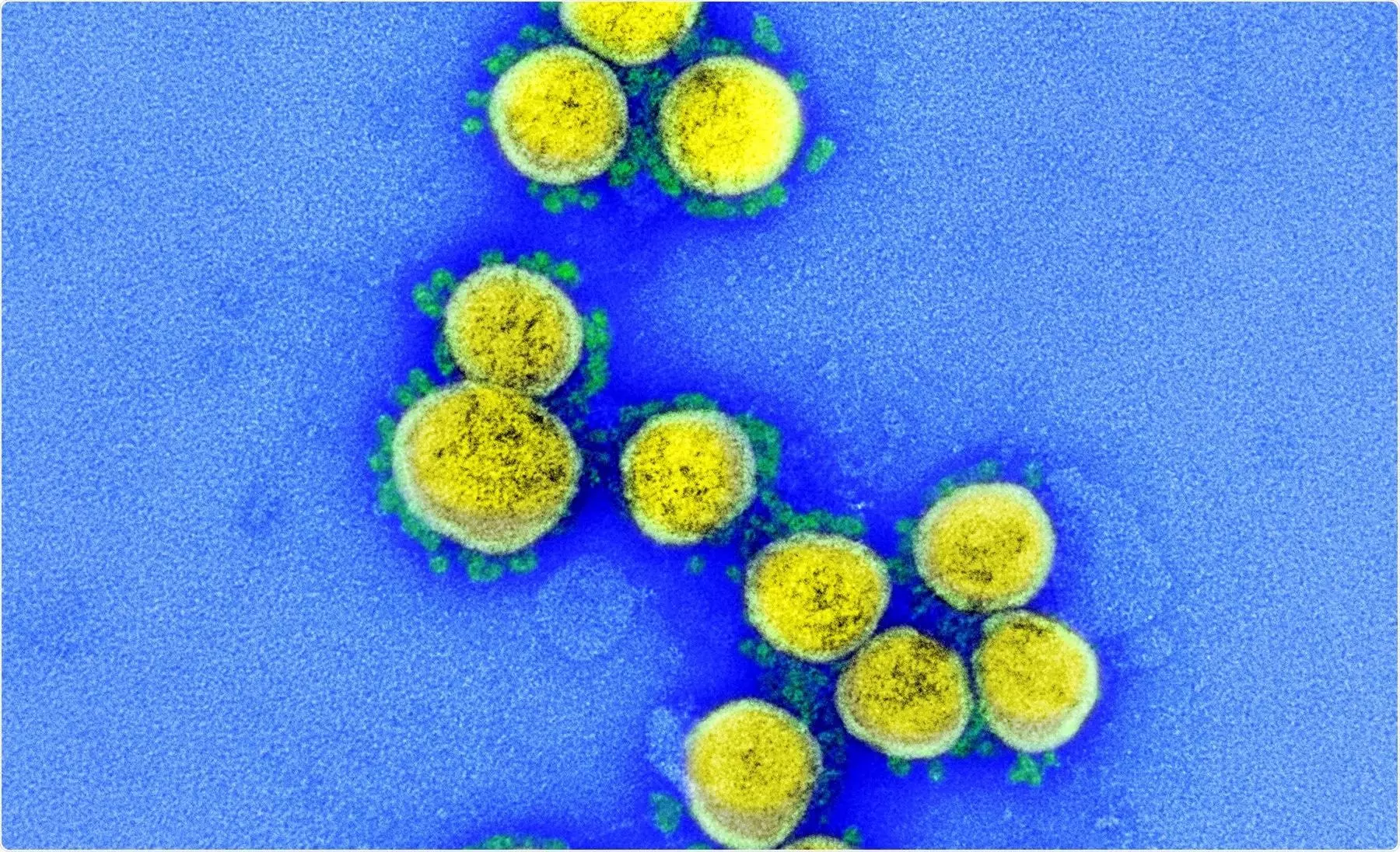 Studiu: SARS-CoV-2 vine cu o rețetă perfectă pentru dezastru: fiecare mutație joacă un rol specific în evoluția variantelor de îngrijorare. Credit imagine: NIAID