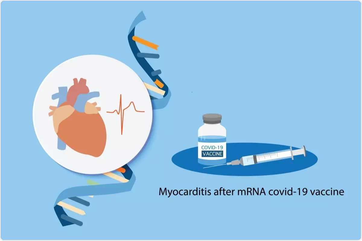 Lo studio valuta le stime del rischio di miocardite e pericardite dai vaccini mRNA-1273 e BNT162b2