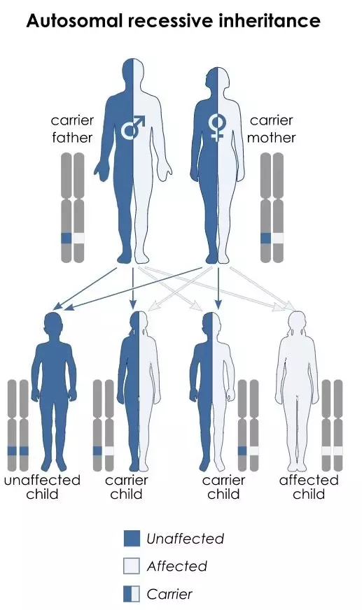 Symptomen fan Aagenaes Syndrome