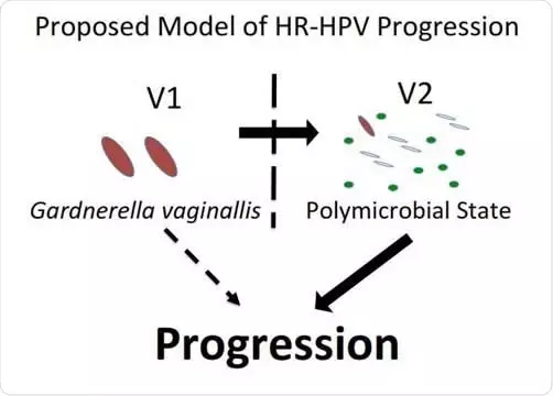 Modell av HPV og mikrobiom interaksjoner. Bildekreditt: PLOS Patogener