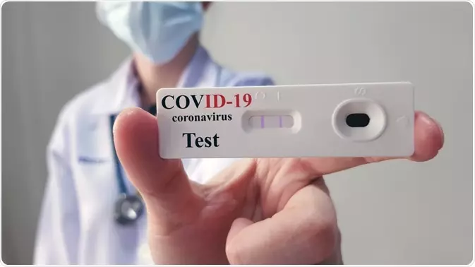 Come funzionano i test degli anticorpi del coronavirus?