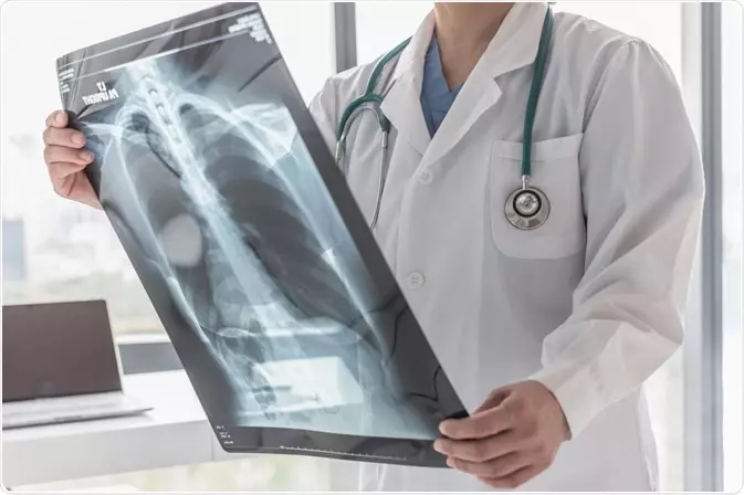 X-Ray بىلەن يۈرەك كېسەللىكلىرى دوختۇرى