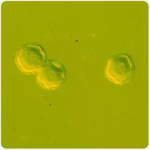 Acanthamoeba يۇقۇملىنىشنىڭ تۈرلىرى