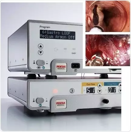 PENTAX Medical inaleta majukwaa mapya ya upasuaji wa kielektroniki na argon ya plasma ya mgando 28833_1