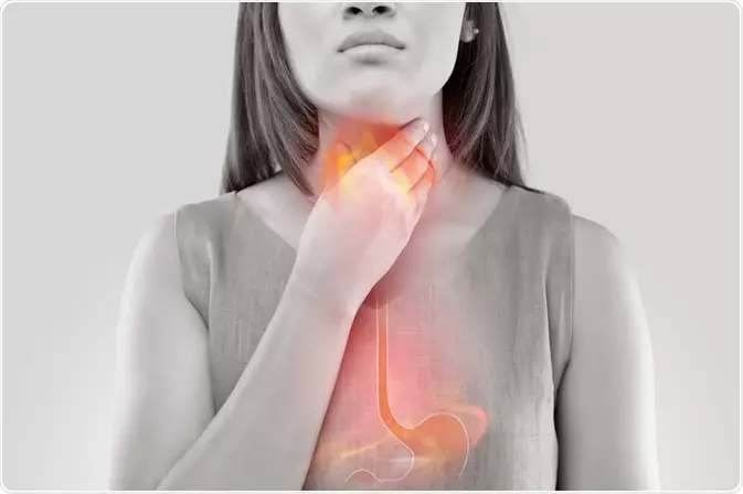 O le a le Heartburn (Acid Reflux)?