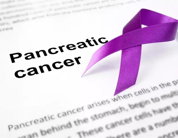 Ofufuza apeza njira yatsopano yopangira chithandizo cha chemotherapy kwa odwala khansa ya pancreatic