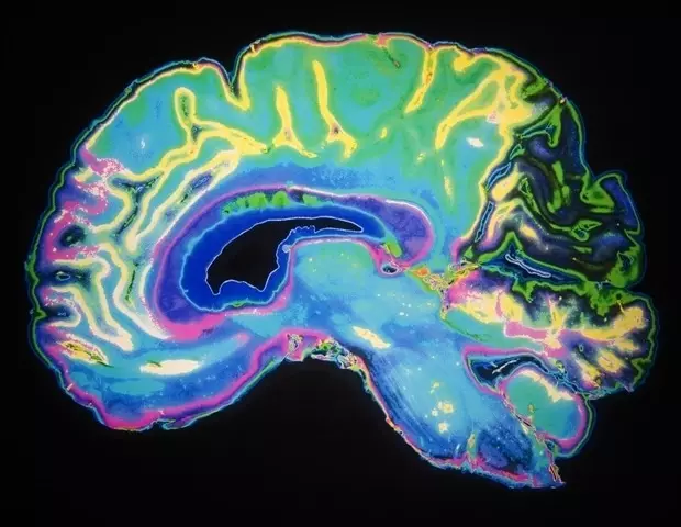 Neuroscientist meneroka penyelidikan terkini ke dalam otak waktu malam untuk memahami faedah sebenar tidur