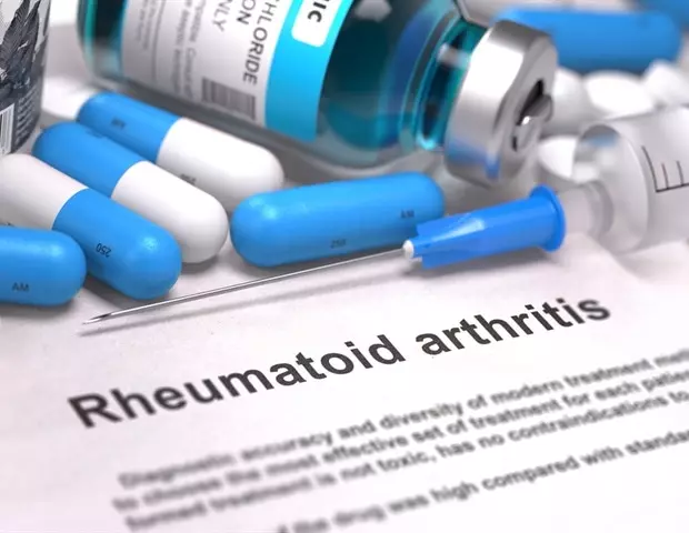 Ny fototarazo vaovao tafiditra amin'ny arthritis rheumatoid dia hita