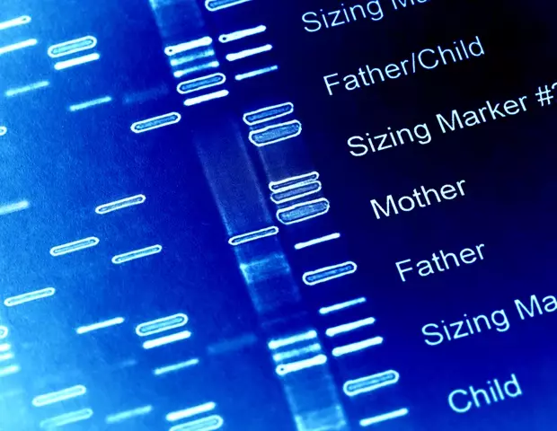 Dupuytren xəstəliyinin və ya kontrakturasının arxasında genetik təsirlər