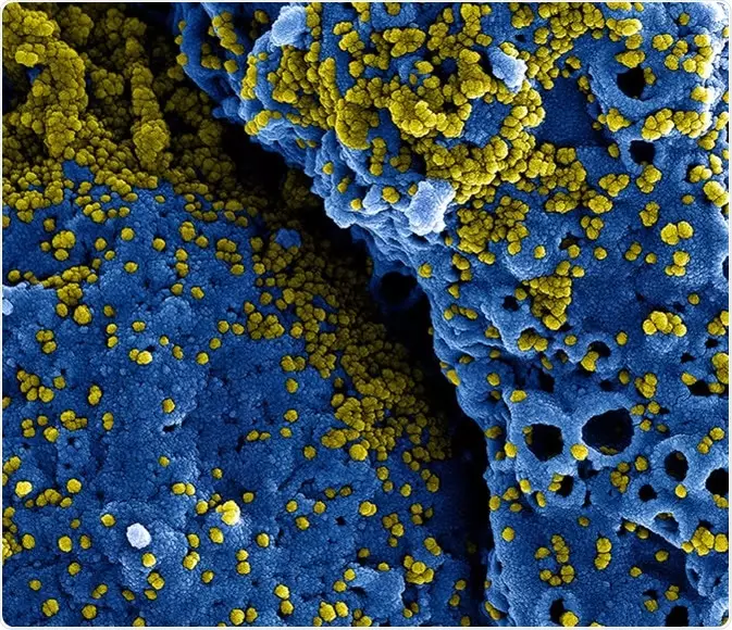 Partículas de coronavirus MERS Micrografía electrónica de varrido coloreada de partículas do virus MERS (amarelo) tanto brotando como unidas á superficie das células VERO E6 infectadas (azul). Imaxe capturada e mellorada na cor no NIAID Integrated Research Facility en Fort Detrick, Maryland. Crédito: NIAID