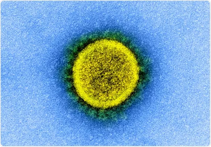 Coronavirus Úrscéal SARS-CoV-2 Leictreonmhicreagraf tarchurtha de cháithnín víreas SARS-CoV-2, scoite amach ó othar. Íomhá gafa agus dath feabhsaithe ag Saoráid Taighde Comhtháite NIAID (IRF) i Fort Detrick, Maryland. Creidmheas: NIAID