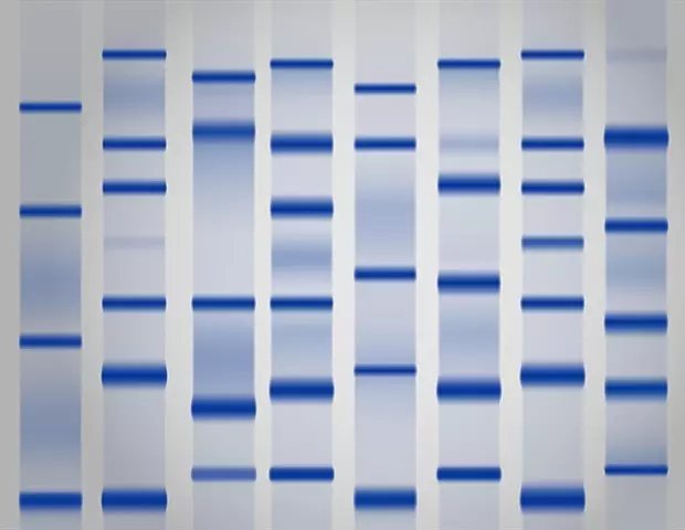 Western Blot — laboratorijas tehnika, ko izmanto proteīnu noteikšanai