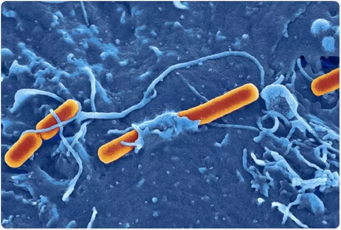 Shigella flexneri - ණය: David Goulding, Wellcome Trust Sanger Institute