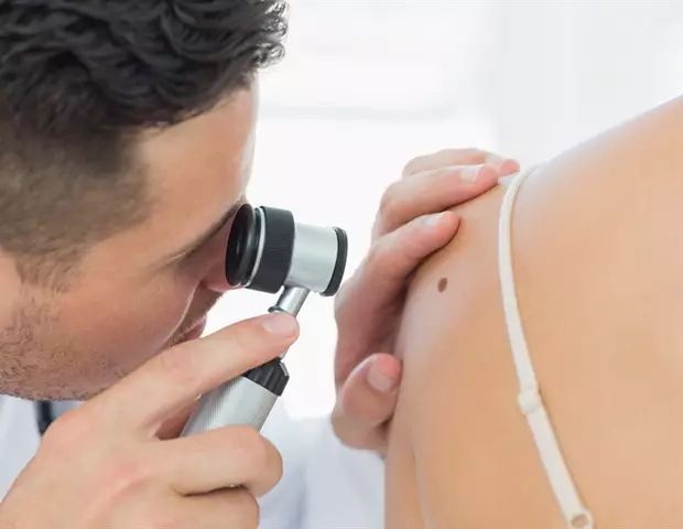 Teşhîsa Keratosis Actinic