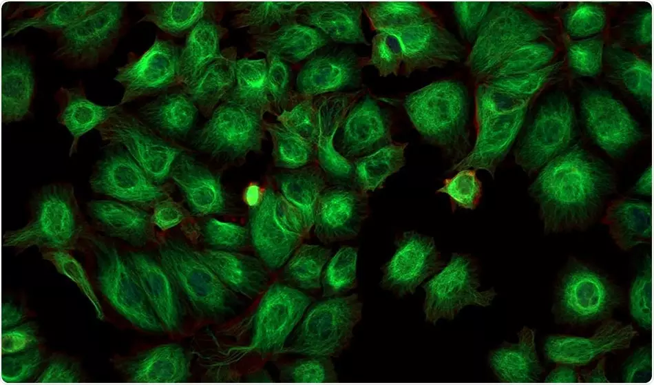 Porovnanie FRET a Yeast Two-Hybrid Systems 4553_1