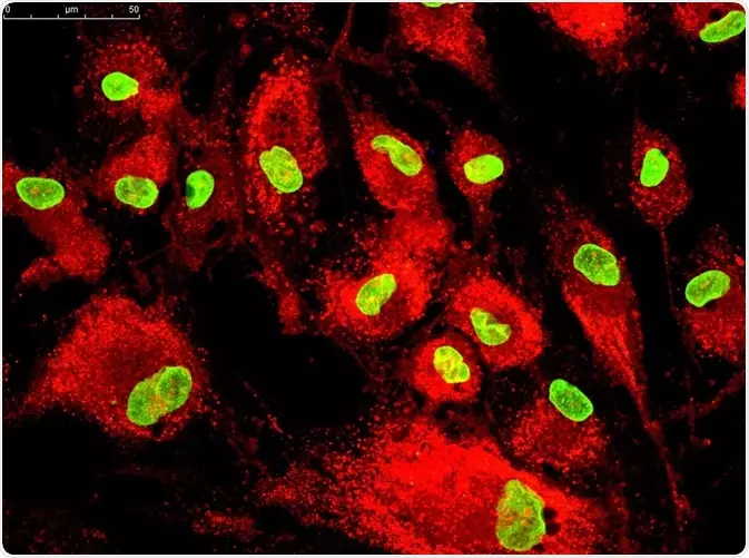 Qelizat staminale mezenkimale të etiketuara me sonda fluoreshente