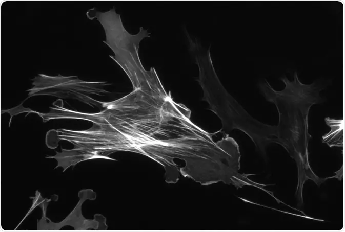 Tala'aga ma Fa'agasologa ole X-Ray Microscopy 4786_1