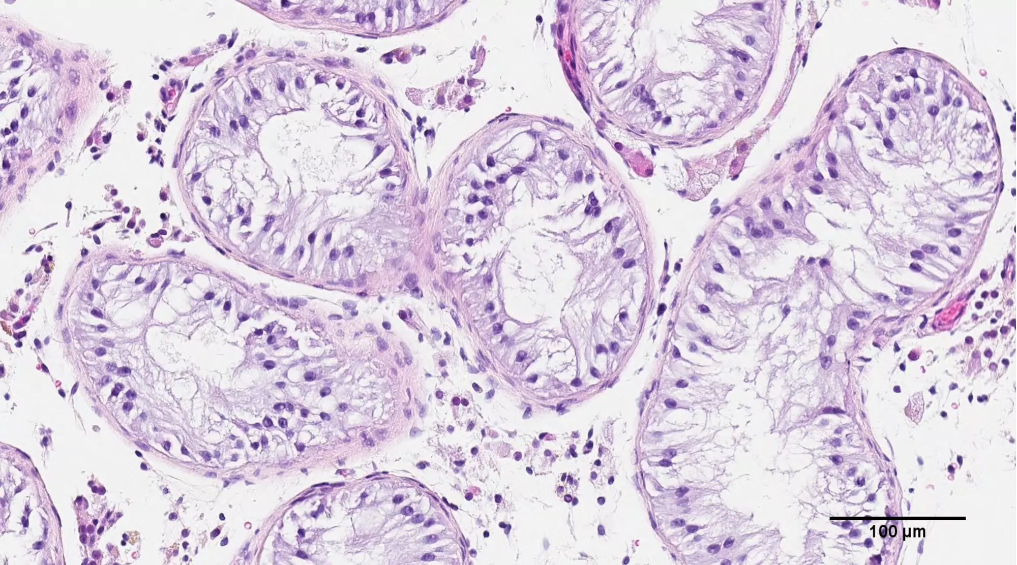 Biopsie des cellules testiculaires