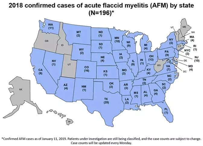 Umuti ukabije wa Flaccid Myelitis