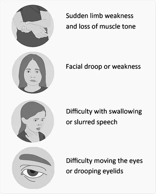 Acute Flaccid Myelitis Lisosa le Tlhahlobo