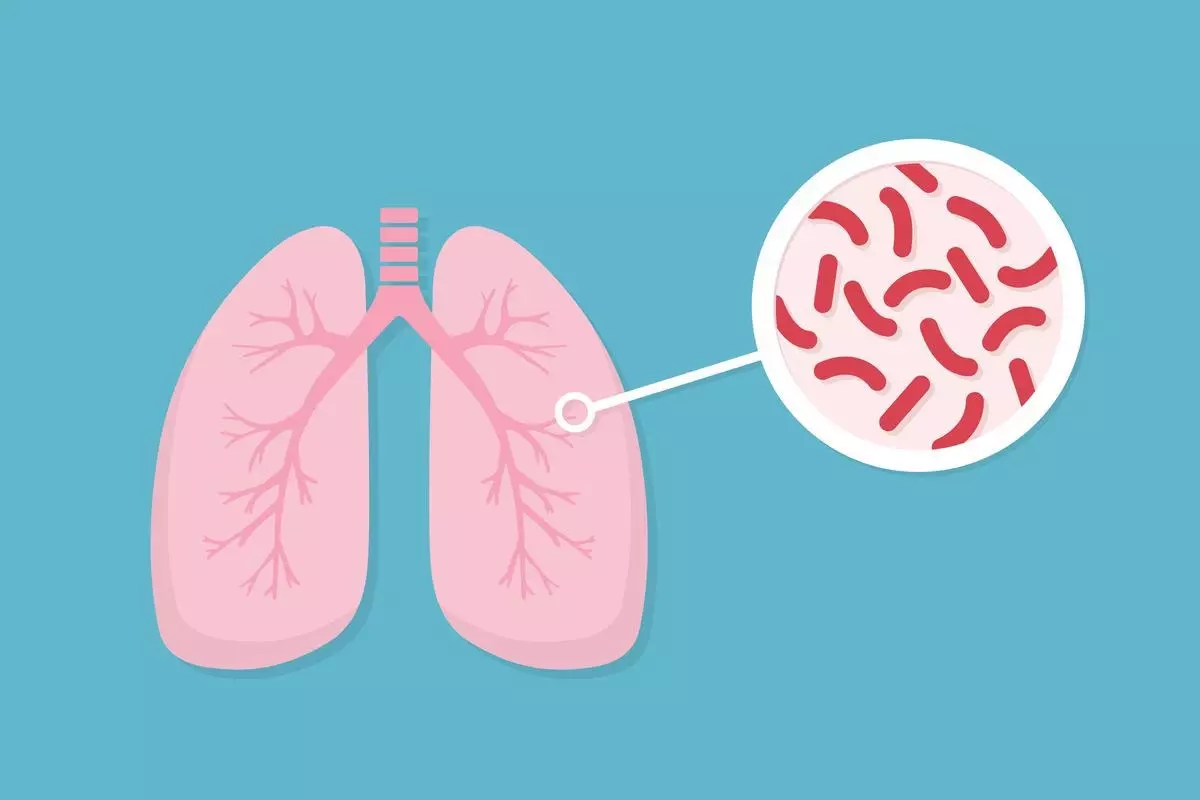 Seguimiento de la adherencia a la medicación para el tratamiento de la TB en África utilizando IA