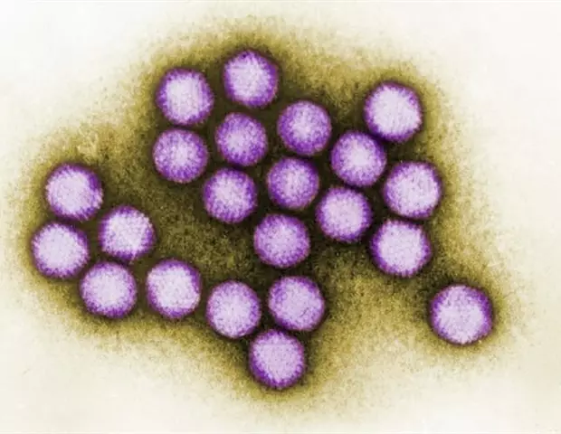 Diagnóstico de infecção por adenovírus