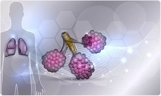 د Idiopathic Pulmonary Fibrosis تشخیص 9918_1