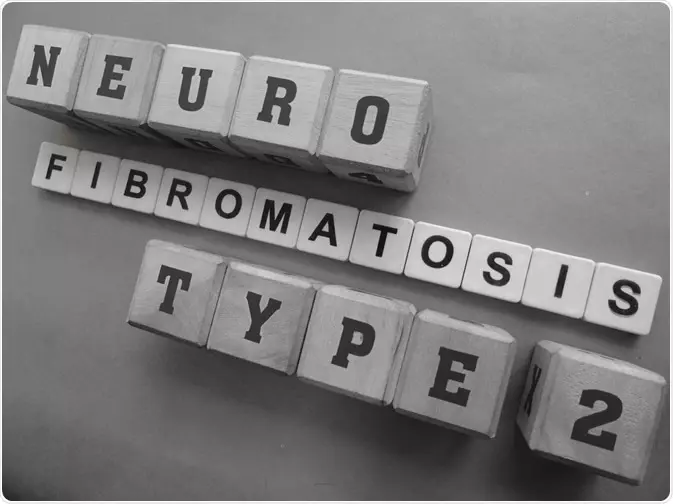 Neurofibromatose tipe 2